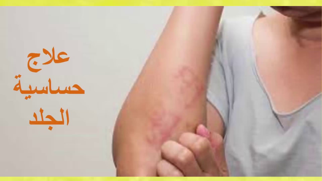 سعر ومواصفات مرهم Treczimus تاروليمس لعلاج الالتهابات الجلدية